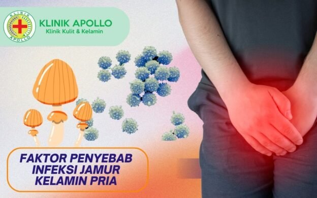 Cara Mengobati Infeksi Jamur Pada Kelamin Pria | Klinik Apollo Jakarta