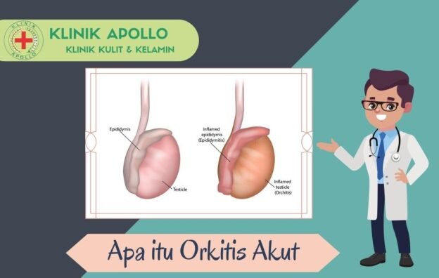Pengertian Orkitis Akut, Apakah Berbahaya?