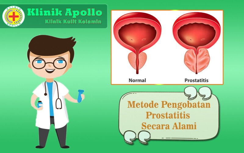 Cara Alami Mengobati Prostatitis Dengan Benar | Klinik Apollo Jakarta