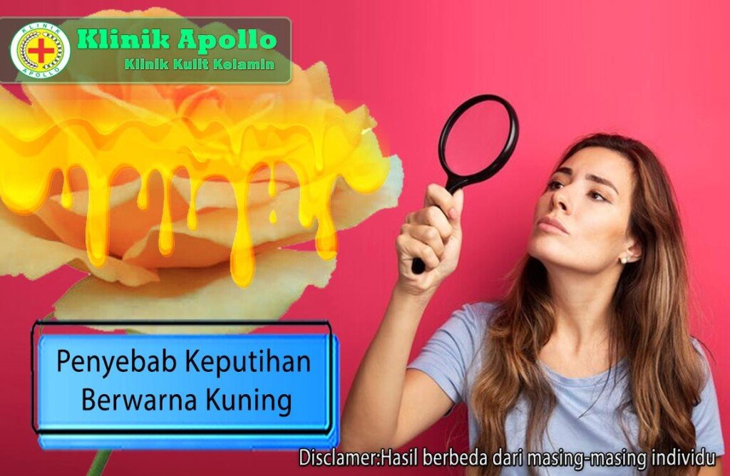 Keputihan Kuning: Penyebab, Gejala, dan Pengobatan