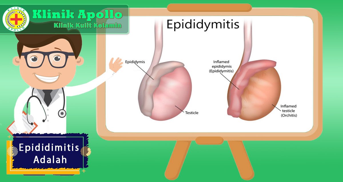 Epididimitis Adalah Inilah Penyebab Dan Gejalanya Klinik Apollo Jakarta