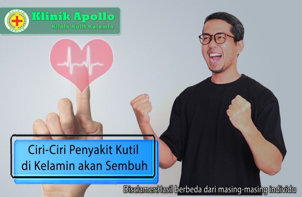 Apa Sajakah Ciri-Ciri Kutil Kelamin yang akan Sembuh? Simak!