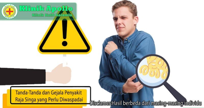 Raja Singa | Klinik Apollo