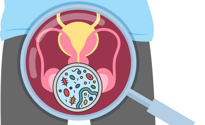 Alat Kelamin Pria Keluar Nanah? Ketahui Penyebab dan Obatnya
