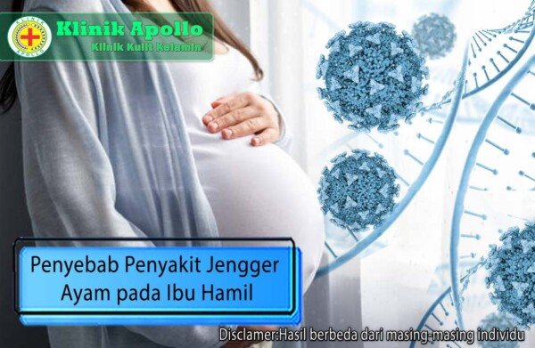 Penyebab dan Gejala Penyakit Jengger Ayam pada Ibu Hamil | Klinik ...