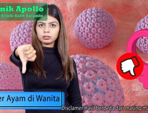 Mengenal Berbagai Fenomena dan Bentuk “Miss V” Jengger Ayam | Klinik Apollo