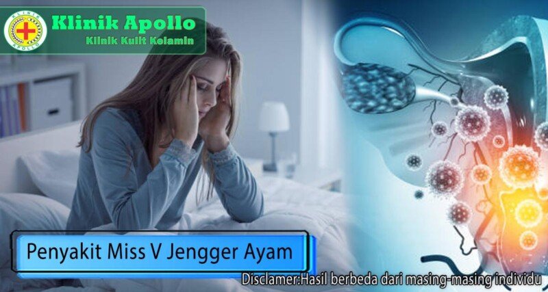 Penyakit Jengger Ayam | Klinik Apollo Jakarta