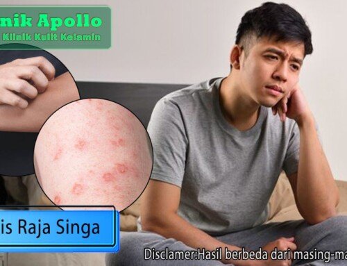 Perhatikan Fase Penyakit Sifilis, Waspada! | Klinik Apollo