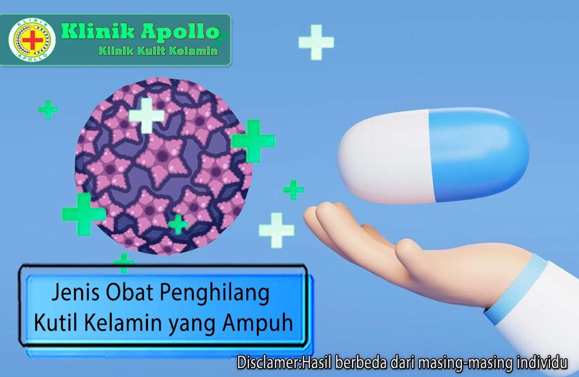 Inilah Obat Penghilang Kutil Kelamin yang Sangat Ampuh | Klinik Apollo ...
