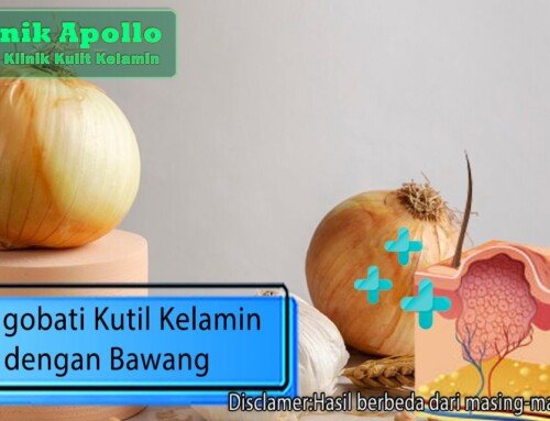 Terlihat Sama, Inilah Perbedaan Kutil Kelamin dan Daging Tumbuh ...