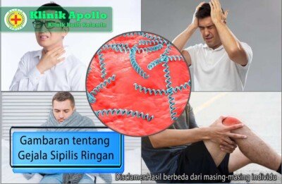 Gejala Sipilis Ringan pada Pria, Apa yang Perlu Anda Ketahui? | Klinik ...