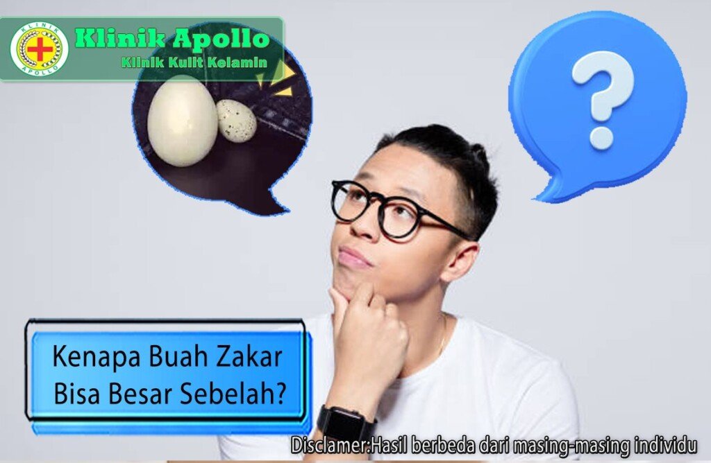 Buah Zakar Besar Sebelah? Jangan Panik Dulu! | Klinik Apollo Jakarta