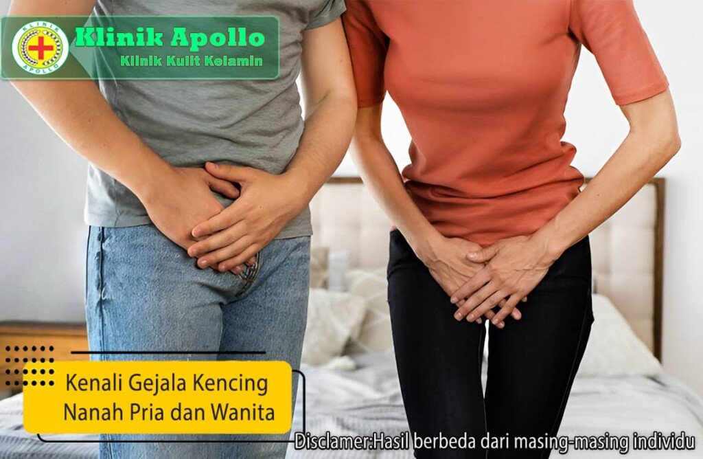 Kencing Nanah Apakah Bisa Diobati? Simak Penjelasan Berikut | Klinik Apollo Jakarta