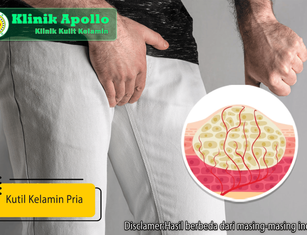 Fakta Seputar Bakteri Penyakit Kencing Nanah | Klinik Apollo Jakarta