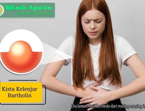 Langkah-Langkah dan Upaya Pencegahan Epididimitis pada Pria